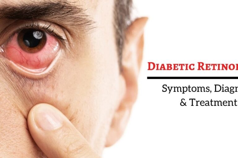 Diabetic Retinopathy:- Symptoms, Diagnose And Treatment